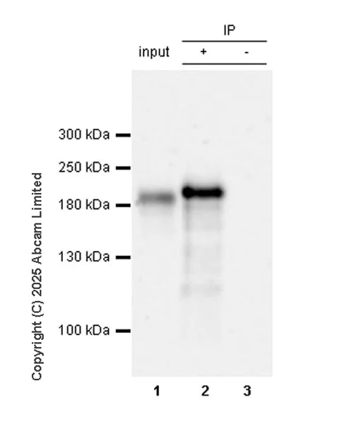 Anti-KDM5B / PLU1 / Jarid1B antibody [EPR30394-502] (ab325395) | Abcam