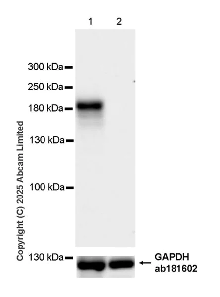 Anti-KDM5B / PLU1 / Jarid1B antibody [EPR30394-502] (ab325395) | Abcam