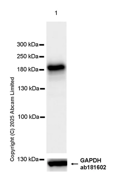 Anti-KDM5B / PLU1 / Jarid1B antibody [EPR30394-502] (ab325395) | Abcam