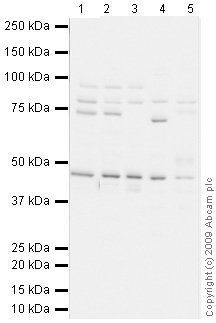 Anti-Kindlin-1 antibody (ab68041) | Abcam
