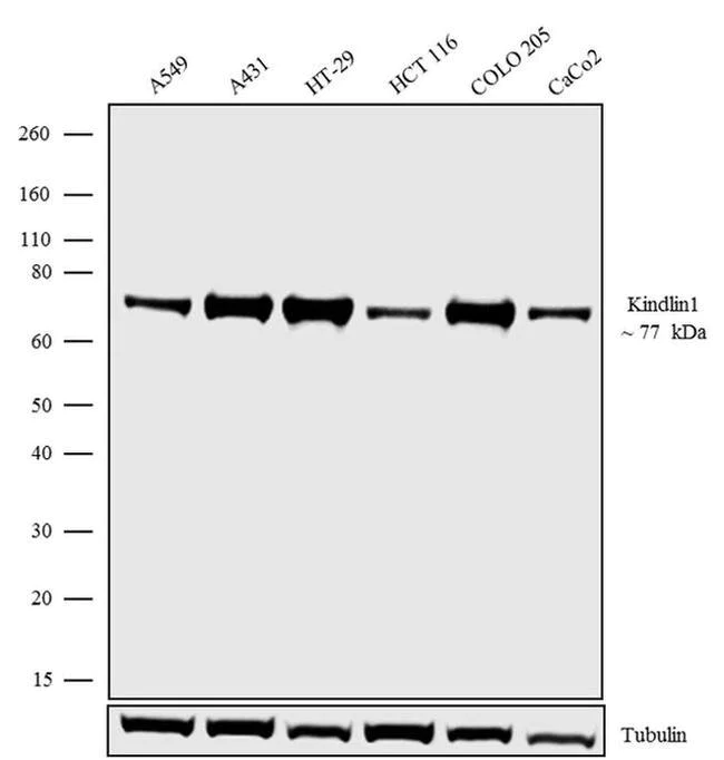 Anti-Kindlin-1 antibody [RP23040116] (ab313441) | Abcam