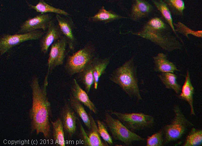 Kir2.1/KCNJ2抗体[S112] (ab85492)| Abcam中文官网