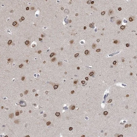 Anti-KMT2D / MLL2 antibody (ab224156) | Abcam