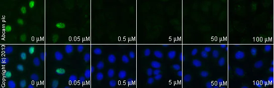 KN-93 (water soluble), CaMK II inhibitor (ab120980) | Abcam
