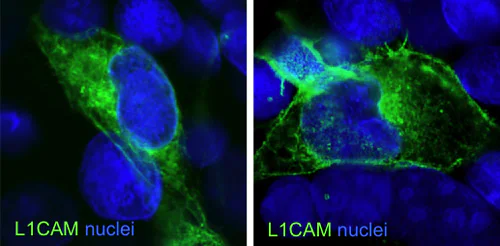 Anti-L1CAM antibody [2C2] (ab24345) | Abcam