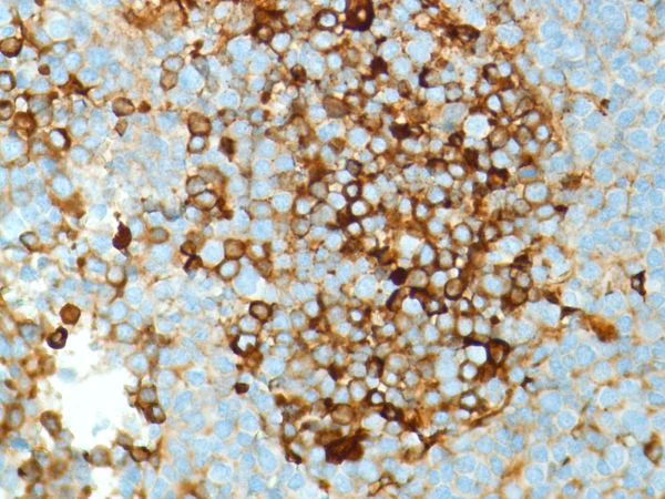 Anti-Lambda Light chain antibody [SP147] - BSA and Azide free (ab245750) | Abcam