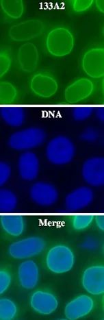 Anti-Lamin A antibody [133A2] - Nuclear Envelope Marker (ab8980) | Abcam