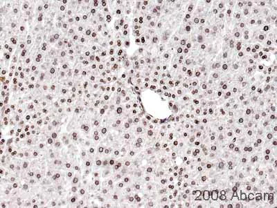 Anti-Lamin A antibody [133A2] - Nuclear Envelope Marker (ab8980) | Abcam