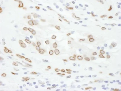 Anti-Lamin A antibody - Nuclear Envelope Marker (ab226198) | Abcam