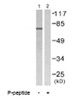 Anti-Lamin A + Lamin C (phospho S392) antibody (ab58528) | Abcam