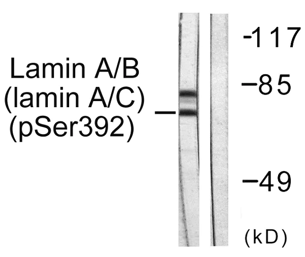 Anti-Lamin A + Lamin C (phospho S392) antibody (ab58528) | Abcam