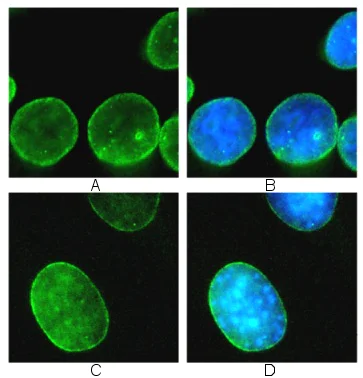 Anti-Lamin B1 antibody - Nuclear Envelope Marker (ab16048) | Abcam