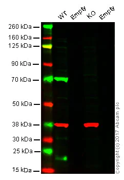 Anti-Lamin B1 antibody - Nuclear Envelope Marker (ab16048) | Abcam