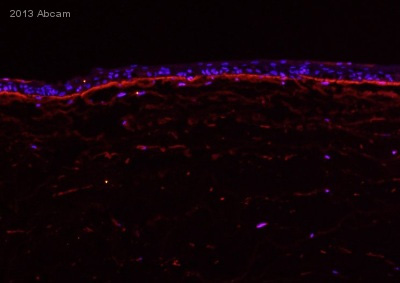 Anti-Laminin gamma 1 抗体 [BC17] (ab41823) | Abcam