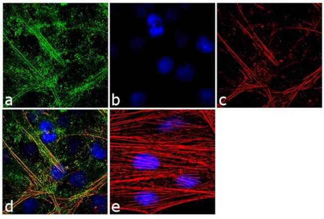 Anti-Laminin alpha 4/LAMA4 Antibody [RP23040173] (ab313467) | Abcam