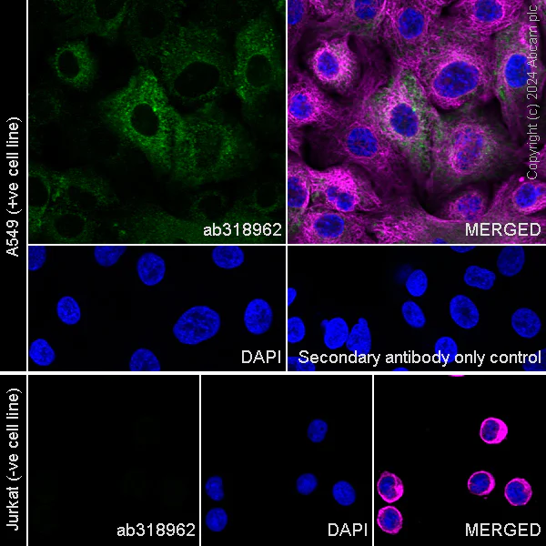 Anti-Laminin alpha 5/LAMA5 antibody [EPR28288-84] - BSA and Azide free ...