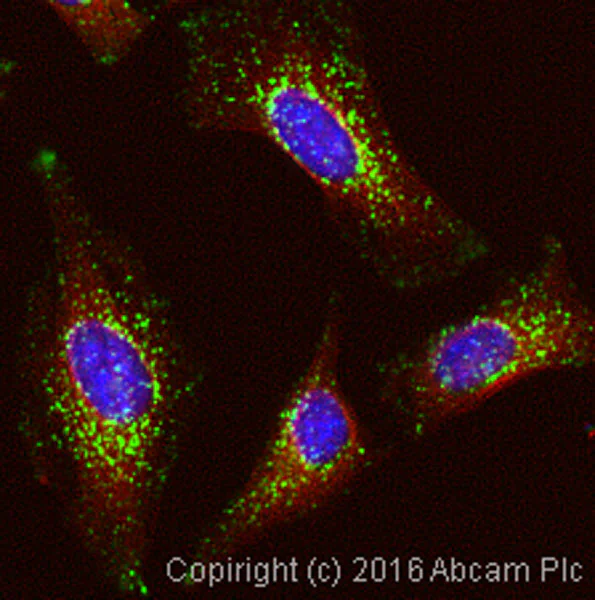 LAMP1抗体[H4A3] - Lysosome Marker (ab25630)| Abcam中文官网