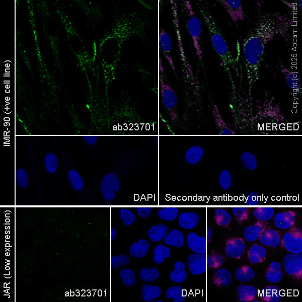 LAMP1抗体[H4A3] - Lysosome Marker (ab25630)| Abcam中文官网