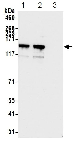 Anti-LARP1 antibody (ab86359) | Abcam