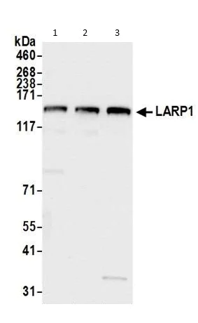 Anti-LARP1 antibody (ab86359) | Abcam