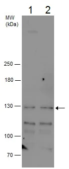 Anti-LARP1 antibody - C-terminal (ab229142) | Abcam