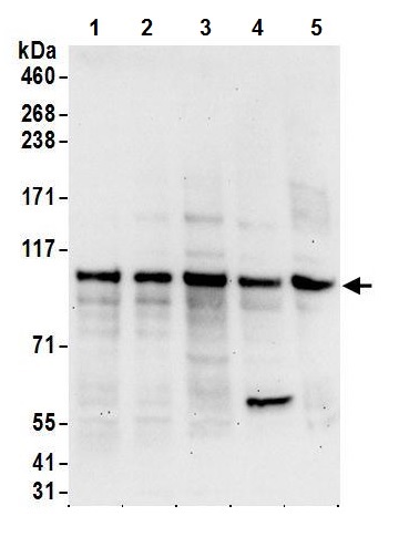 Anti-LARP4 antibody (ab241489) | Abcam