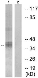 Anti-LAT (phospho Y171) antibody (ab73205) | Abcam
