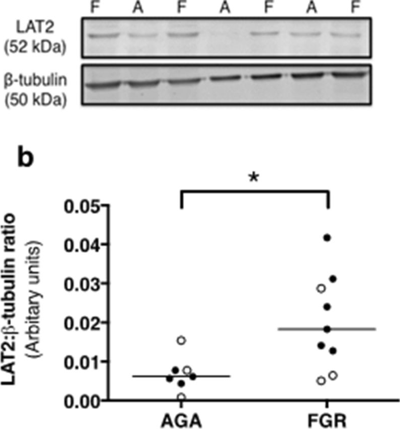 Anti-LAT2 antibody (ab75610) | Abcam