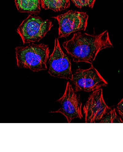 Anti-MAP1LC3B antibody - autophagosome marker (ab51520) | Abcam