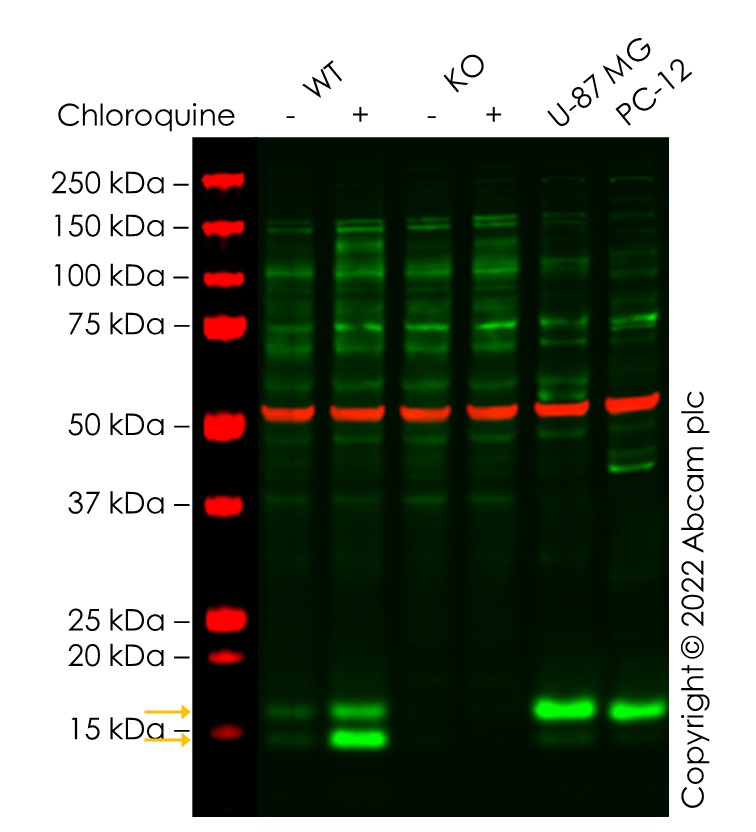 Anti-MAP1LC3B antibody - autophagosome marker (ab51520) | Abcam