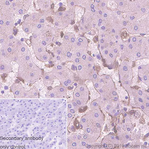 Anti-LCAT antibody [EPR1384Y] (ab51060) | Abcam