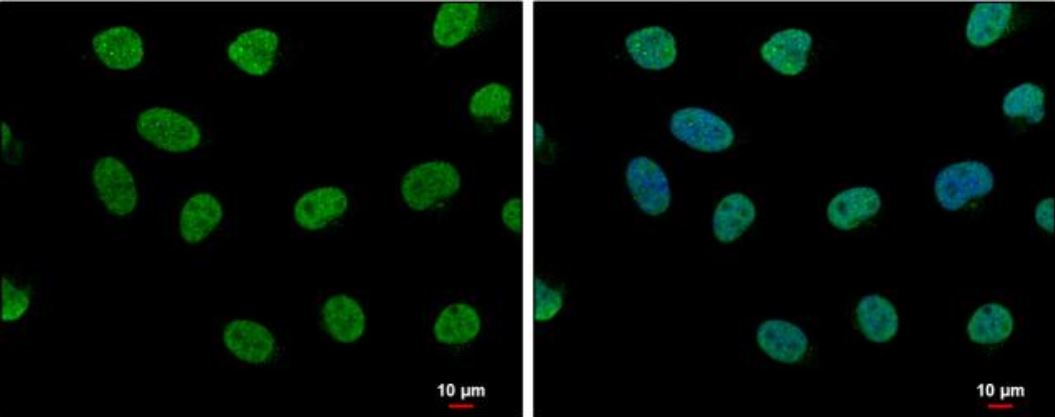Anti-LDB1 antibody. Rabbit polyclonal (ab96799) | Abcam