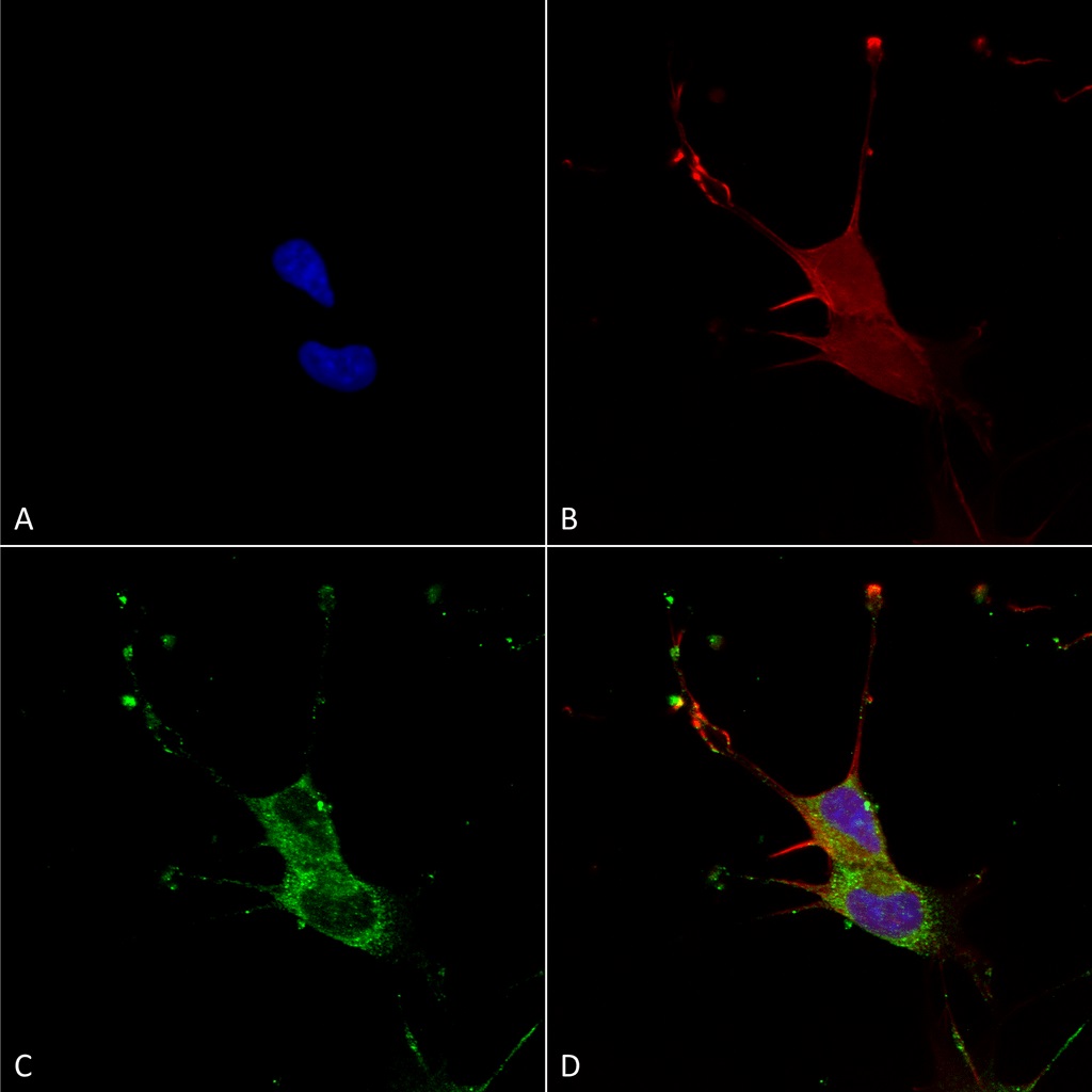 Anti-Lgi1/EPT antibody [N283/7] (ab186296) | Abcam