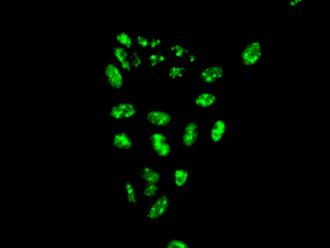 Anti-LIG1 antibody [EPR12464] (ab177946) | Abcam