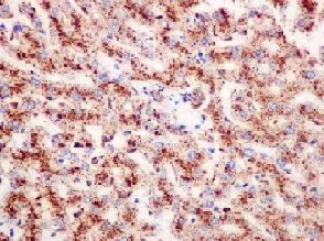 Anti-LIMPII antibody [EPR12080] (ab176317) | Abcam