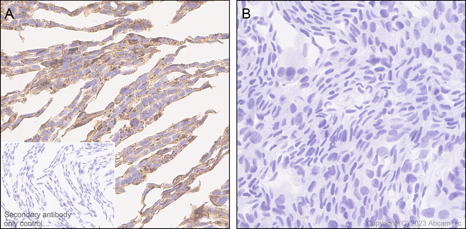 Anti-LIMPII antibody [EPR26243-125] KO Tested (ab314217) | Abcam