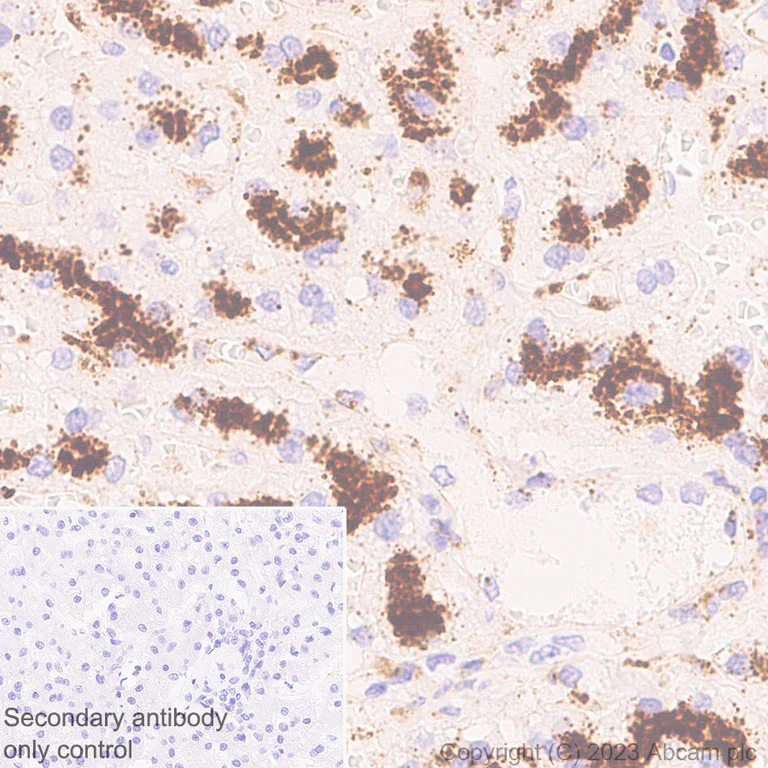 LIMPII抗体[EPR26243-125] (ab314217)| Abcam中文官网