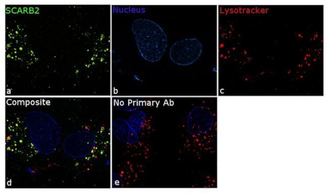 Anti-LIMPII antibody [RP23040256] (ab313546) | Abcam