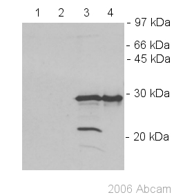Anti-Lin28A antibody (ab46020) | Abcam