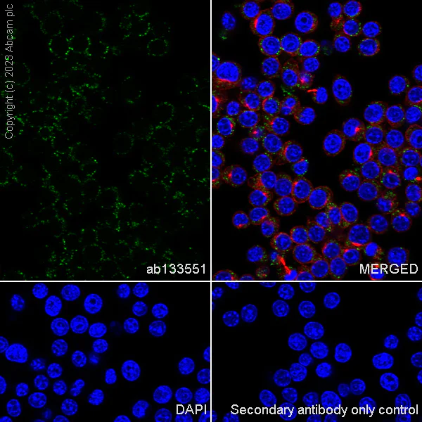 Anti-Lipoamide Dehydrogenase antibody [EPR6635] (ab133551) | Abcam