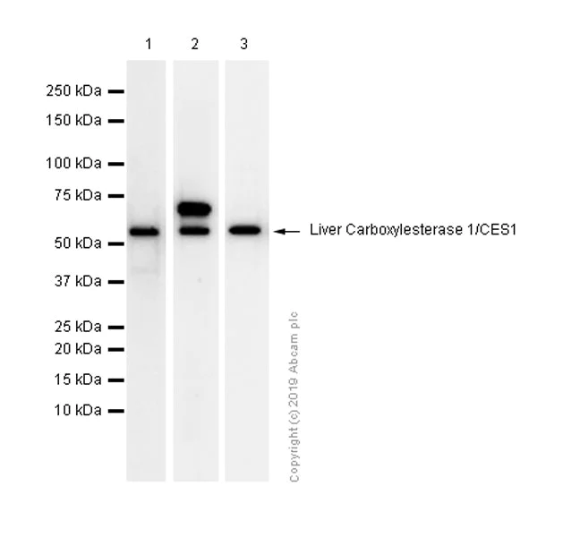 Anti-Liver Carboxylesterase 1/CES1 antibody [EP1375Y] (ab68190) | Abcam
