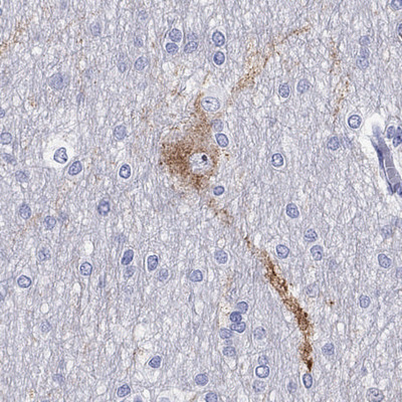 Anti-LMTK3 antibody (ab262938) | Abcam