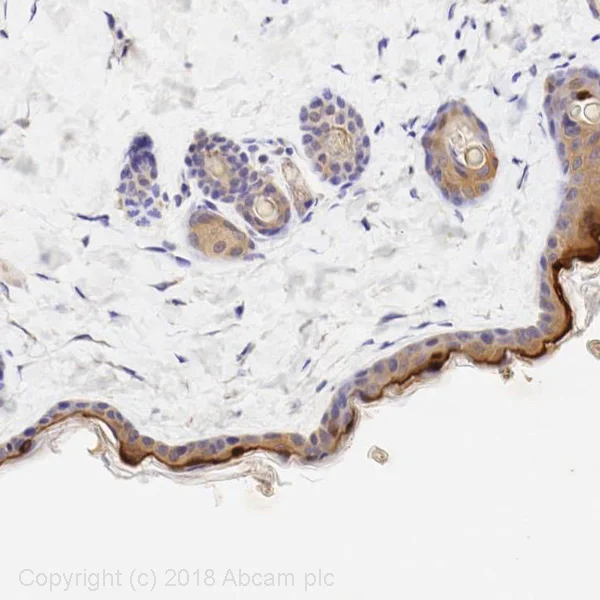 Loricrin抗体 (ab85679)| Abcam中文官网