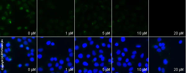 Lovastatin (Mevinolin), HMG-CoA reductase inhibitor (CAS 75330-75-5 ...