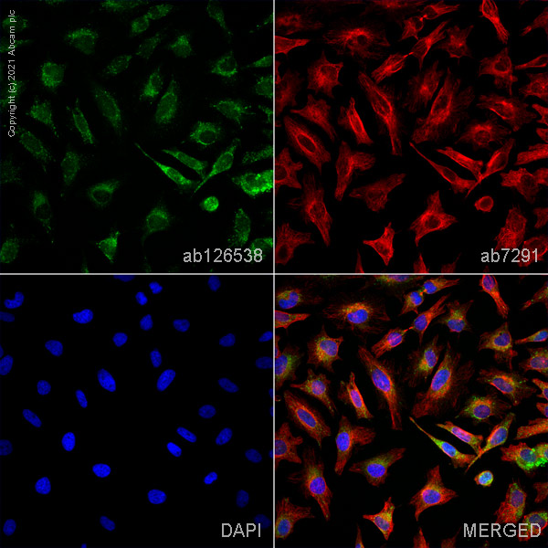 Anti-LOX 1 antibody. Rabbit polyclonal (ab126538) | Abcam