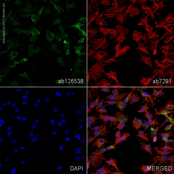 Anti-LOX 1 antibody. Rabbit polyclonal (ab126538) | Abcam