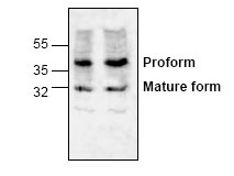 Anti-LOX 1 antibody (ab60178) | Abcam