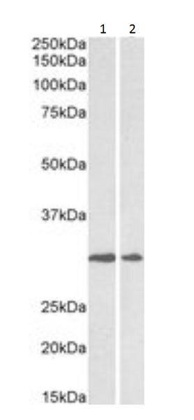 Anti-LOX antibody (ab223488) | Abcam