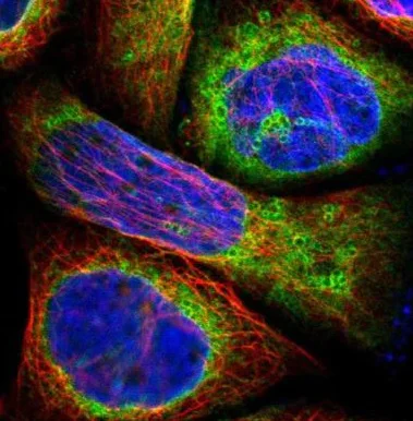 LPCAT-2抗体 (ab224244)| Abcam中文官网