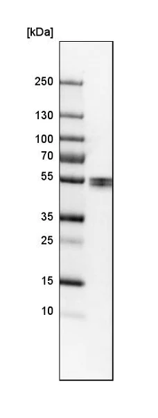 LPCAT-2抗体 (ab224244)| Abcam中文官网